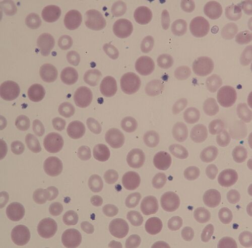 Dimorphic - haematologyetc.co.uk