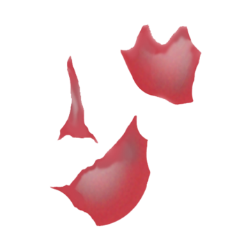 Fragmented cells - haematologyetc.co.uk