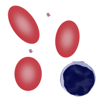 Elliptocytes - haematologyetc.co.uk