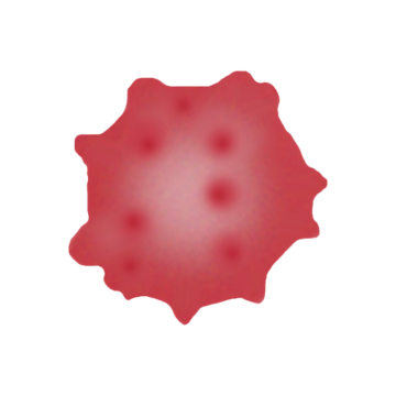 Echinocytes - haematologyetc.co.uk