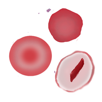 Haemoglobin crystals - haematologyetc.co.uk