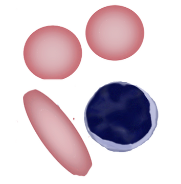 Pencil cells - haematologyetc.co.uk