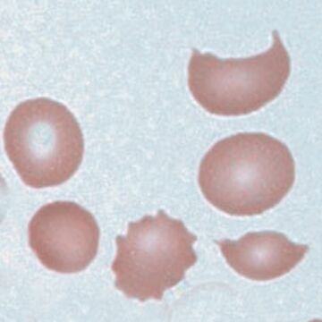 Keratocytes - haematologyetc.co.uk