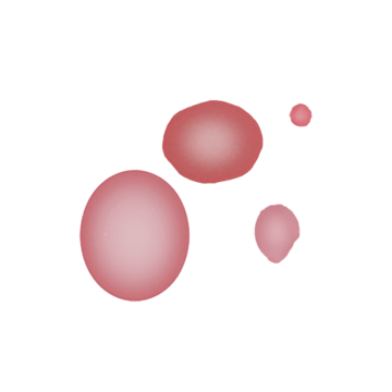 Fragmented cells - haematologyetc.co.uk