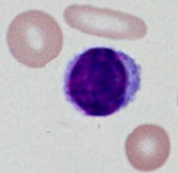 Pencil cells - haematologyetc.co.uk