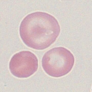 Target cells - haematologyetc.co.uk